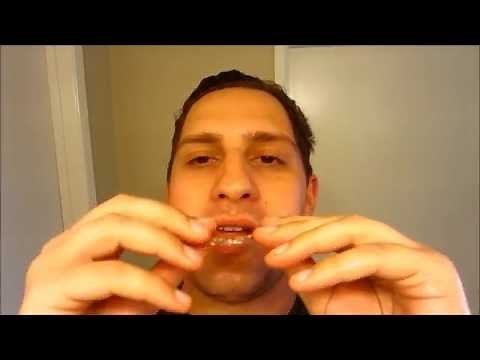 How To Put on Spring Retainers!