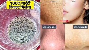 599K views · 10K reactions | चाय की पत्ती से हटाएँ खुले रोम छिद्र व्हाइटहेड ब्लैकहेड्स - जानिए कैसे Remove open pores, whiteheads, blackheads with tea leaves #blackheads #whiteheads #cloggedpores #openpores #homeremedies #diyfacepack #beautytips #beautufulgirls #beautyhacks #beautyblogger #beautyinfluencer #glowingskin #noseglow | Beauty Secrets Hindi | Facebook