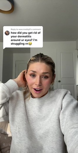 How I Got Rid of My Dermatitis: Tips and Treatment