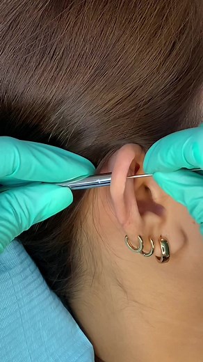 All About Flat Piercing: Procedure, Pain Level, and Aftercare