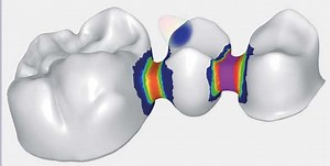 exocad dental software para dentistas de venta en 3dmarket
