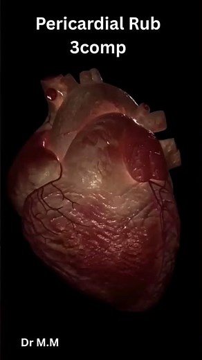 The TRIPLE Sound of Pericarditis! 🔥 (3-Component Rub) #MedEd