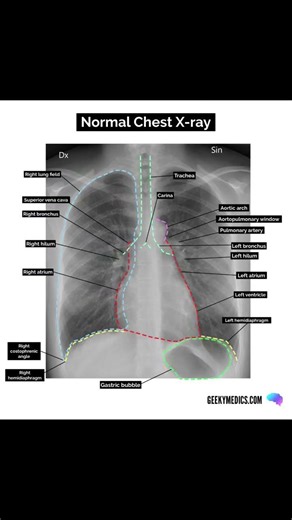 thorax x-ray #mbbs #explained # mbbs scholarship #mbbs Sensei
