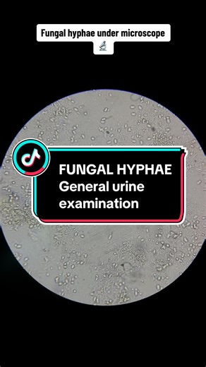Exploring Fungal Hyphae Under Microscope