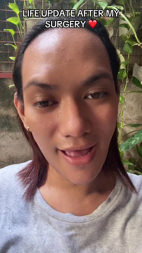 lofe after my open heart surgery