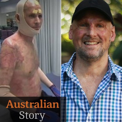 284K views · 1.4K reactions | Brave. Inspirational. Extraordinary. Matt Golinski has been called a lot of things, but he says he’s just getting on with life the best he can. For the first time, the celebrity chef is sharing his story of how he overcame horrific burns and the unimaginable loss of his family in a house fire. Full episode: https://ab.co/2vGIJBR | Australian Story | Facebook