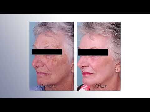 The Spectrum - Device Overview