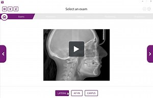 Hyperion X9 PRO 2D Lateral Ceph Acquisition