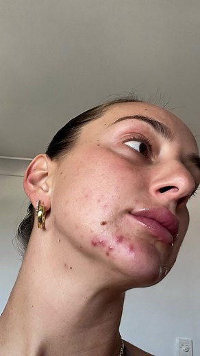 Cómo lograr una piel radiante con Erin Louise Camilleri