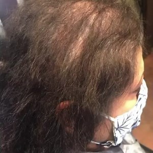 The #MicroLines System is permanently attached to one's own hair and can be worn over the course of many months with in-between touch up services for the ultimate thinning hair solution. Become a Hairdreams pro and help us make #LifeChangingTransformations. For more information visit https://bit.ly/MicroLinesPro. ⠀⠀⠀⠀⠀⠀⠀⠀⠀ 📸: celebrationsalon | Hairdreams Plus