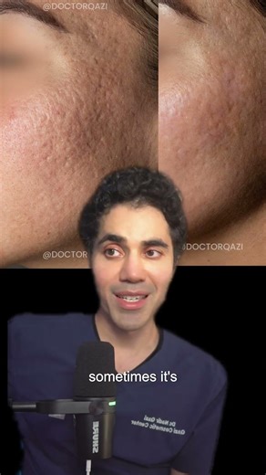 Are Thicker Scars Harder to Treat?