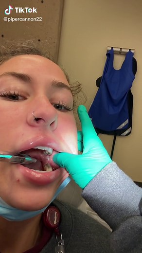 Dental Injection Techniques Explained by Dental Students ft. @sarahschief