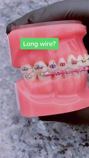 How to Cut Long Braces Wire Easily