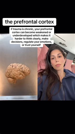 Somatic Exercises with Liz Tenuto on Instagram: "how long-term stress & cortisol impact your pre-frontal cortex in your brain👇🏼 long-term stress spikes your cortisol and dysregulate your nervous system which disrupts the functioning of your prefrontal cortex 🧠 you may think you have symptoms of ADHD, but there’s a lot of overlap in cognitive challenges from long-term stress and ADHD ADHD is a neurodevelopmental condition that starts in childhood, and an ADHD diagnosis is so much more than jus