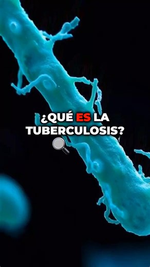 Understanding Arthur Morgan's Tuberculosis in Red Dead Redemption 2