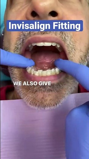 Invisalign fitting appointment, followed by use and care instructions.