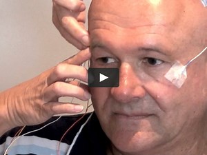 Peninsula Sleep Clinic Sleep Study Set Up Example Video