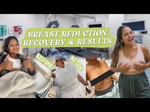 Breast Reduction & Lift Recovery Vlog + RESULTS | DDD to C Cup | Westlake Dermatology Dr. Chike Obi