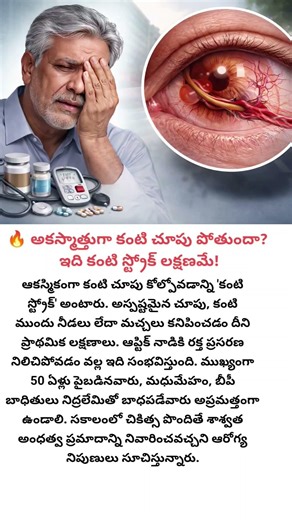 Can Your Eyes Get a Stroke? The Shocking Truth You Must Know😱