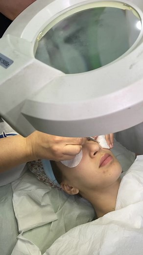 24K views · 155 reactions | Extraction des comédons formation esthétique | Institut Karisma | Facebook