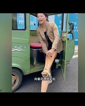 The beautiful woman has very short legs. She uses a prosthetic leg as if it were an amputee # ampute