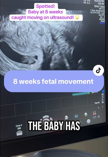 8-Week Embryo Development: Key Growth Milestones