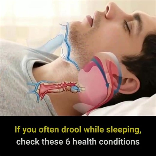 3.8K views · 11 reactions | Drooling during sleep may seem like a harmless inconvenience, but it can be a sign of underlying health issues that need attention. If you frequently wake up to a wet pillow, it might be worth investigating these potential causes. | Feedy | Facebook