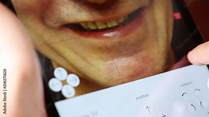 Digital technology. CAD CAM system. Teeth before and after prosthetics. Smiling man. Dental practice. This is smile design project. The dentist projects a smile and shows you how it will look in the