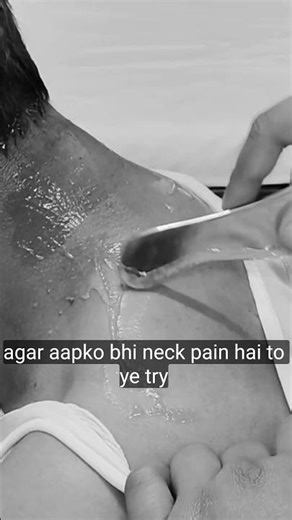 IASTM technique 👍 #physiotherapy #shorts