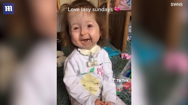 Little girl with Benjamin Button disease makes paper heart for mum
