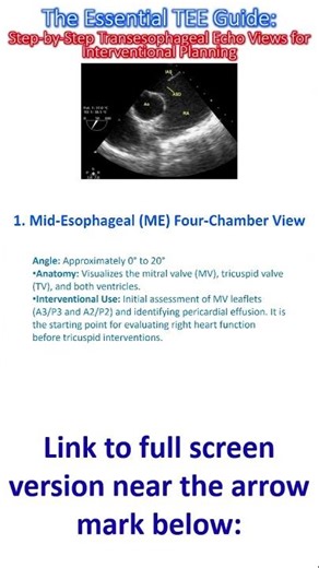 The Essential TEE Guide: Step-by-Step Transesophageal Echo Views for Interventional Planning