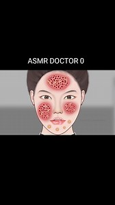 ASMR Removal | 2 #asmr #animation #satisfying #viral #trending #shorts #asmrremove #fbreels #viralreelfb #viralfb #asmrsounds #satisfying #reel #trend #reels #animationstudio #BOOMchallenge | Asmr Aijul