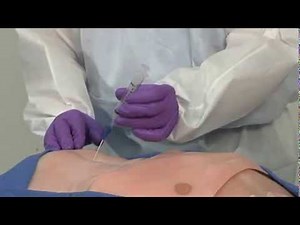 Diagnostic Peritoneal Lavage (DPL)