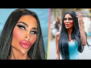 BOTCHED Plastic Surgery That Made Celebrities Unrecognizable | Marathon