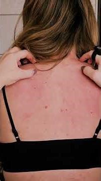 Gentle Back Scratching ASMR for Deep Relaxation #asmr #sleepasmr #relaxingasmr #asmrsounds #tingles