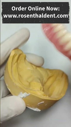 Affordable Full Lower Denture: Get Your Perfect Fit Without Breaking the Bank!