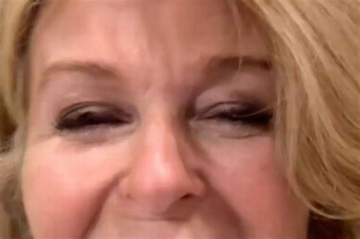 Kate Garraway shows off 'horror' injury after taxi collision leaves GMB presenter with cracked teeth