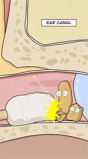 Why Your Earpods Suddenly Sound Quiet