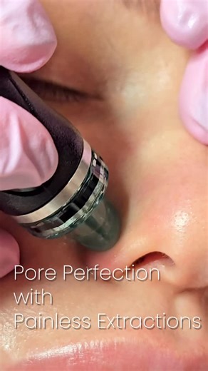 Aponi Aesthetics on Instagram: "The ideal skincare treatment for your holiday glow - The Platinum Hydrafacial that includes cleansing, exfoliation, extraction, hydration, LED therapy, lymphatic drainage, and targeted boosters all in one treatment. Key benefits: 1. Deep, Painless Cleansing & Exfoliation * Removes dirt, oil, and dead skin for an instantly smoother complexion. * Unclogs pores without irritation. 2. Intense Hydration * Delivers hydrating serums with hyaluronic acid and antioxidants.