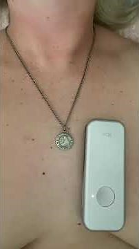 Visible Neck Pulse and Heartbeat