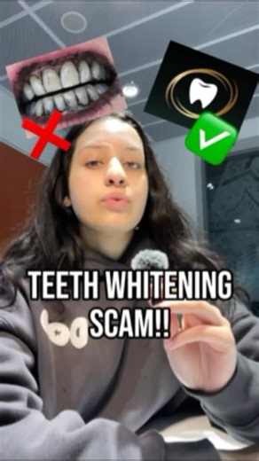 zahrasmilesbright on Instagram: "@synergydentalclinic THE TEETH WHITENING SCAM ‼️ don’t fall for this common mistake when it comes to improving the aesthetic appearance of your teeth 🦷 This is my first reel for @synergydentalclinic in hopes of informing patients to make better decisions about their oral care routine 😁 Remember to use reputable teeth whitening products and services such as that offered by renowned companies like Synergy Dental!"