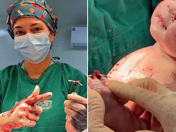 Newborn baby pictured ‘victoriously’ holding mum’s contraceptive IUD that failed to prevent pregnancy