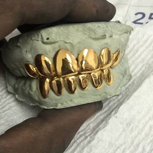 9.1K views · 43 reactions | NO FILTER: DEFINITION OF GLASSHOUSE!!!!! 6T/6B NPG w/24k Dip $35 per tooth SERIOUS INQUIRIES ONLY! (954)832.6698 or (954)440.4367 SAME DAY SERVICE AVAILABLE!!! | Wall2Wall Grillz | Facebook