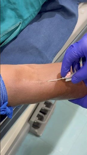 How to Insert a 20 Gauge IV Line for CT Scan | Step-by-Step Guide for Medical Professionals#shorts