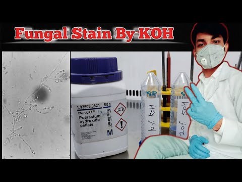 fungal stain by KOH | fungal stain KOH | KOH mount | fungal staining procedure | Potassium hydroxide