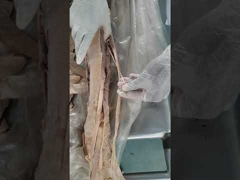 Anterior Leg Compartment Dissection