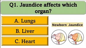 12K views · 558 reactions | Top 20 Interesting GK || Most 20 Interesting GK Questions| Important 20 GK Questions And Answers | Test Preparation MCQ's | Facebook