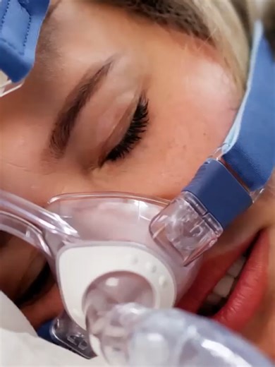 🔹Orthognathic surgery can transform your breathing and sleep! Obstructive sleep apnea (OSA) affects sleep and health by disrupting nighttime airflow. Therefore, when conservative treatments fail, maxillomandibular advancement becomes an effective option, as it widens the airway, improves ventilation, and reduces apneic episodes, promoting restful sleep. In addition to its functional benefits, this technique improves facial harmony in cases of retrognathia or maxillary hypoplasia through precise