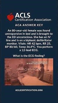 ACLS Megacode 3 Q1 Answer Key #aclsmegacode #acls #reels