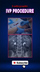 IVP test 🥺 #xray #ivptest#radiologyschool #xraytechnician #eduction